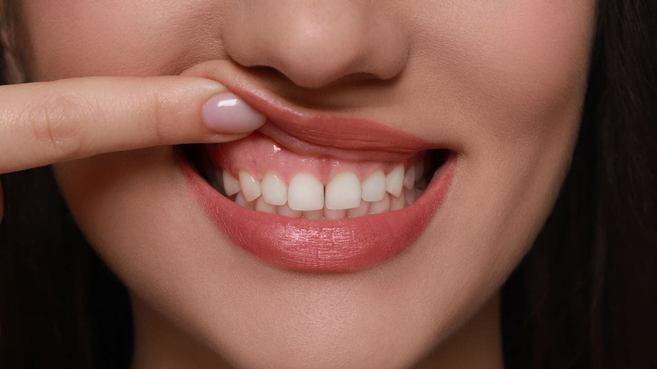 Descubre qué significa una bolita blanca en la encía y cómo tratarla