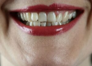 Cómo arreglar un diente roto en casa: trucos y consejos efectivos